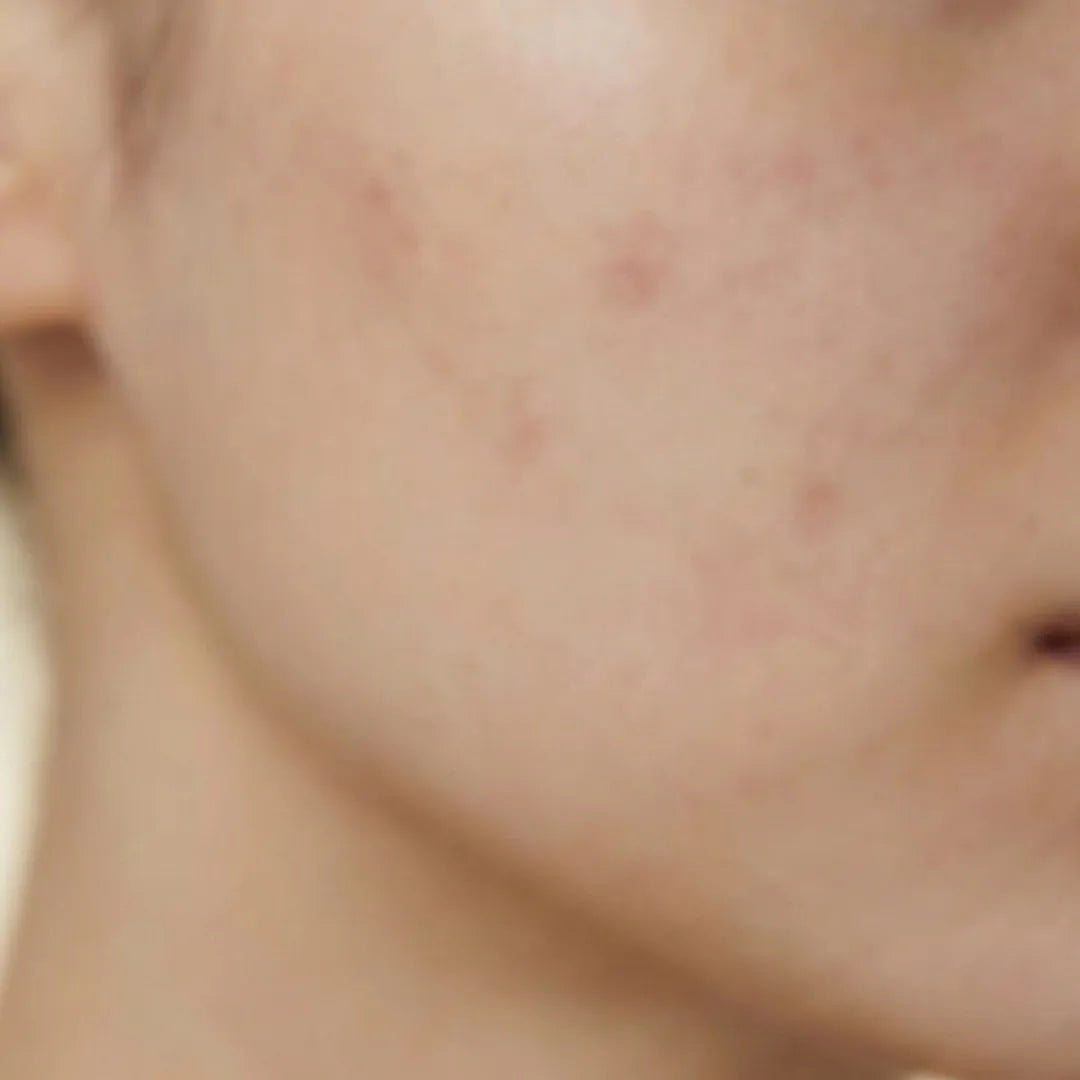Best Organic Skincare Products for Glowing Skin in India – Every Tone